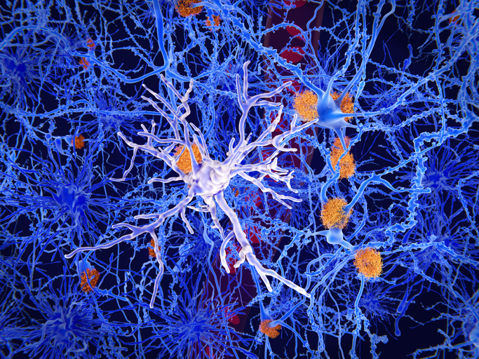 Alzheimer’s Phase II for TREM2 Antibody Shows No Treatment Benefit ...